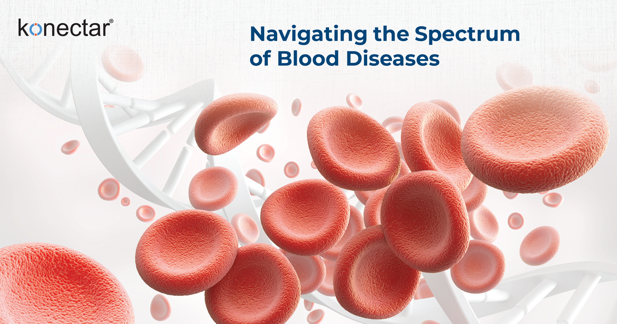 Exploring Blood Diseases: Key Insights